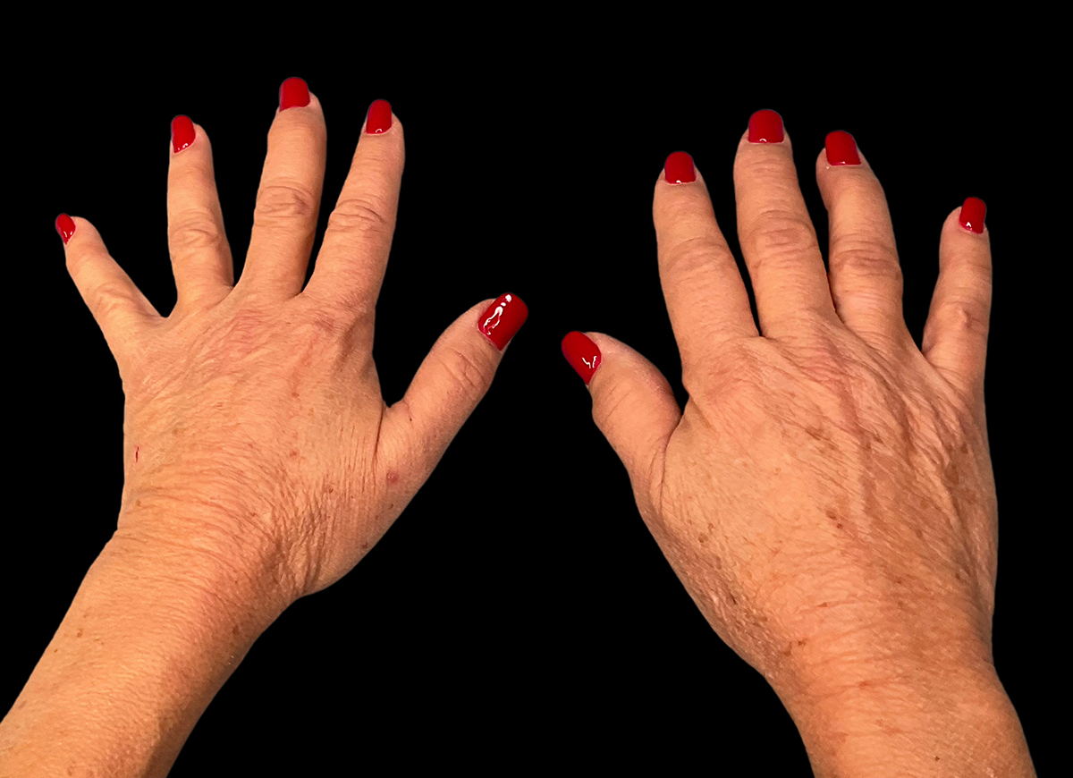 Before & After Photos Of Medical & Cosmetic Dermatology